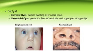 Examination of nose | PPTX