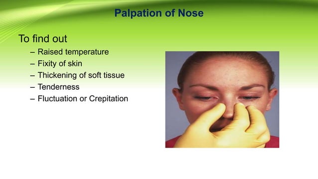 Examination of nose | PPTX