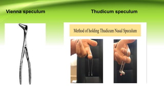 Examination of nose | PPTX