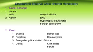 Examination of nose | PPTX