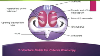 Examination of nose | PPTX