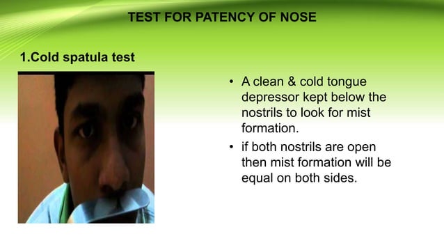 Examination of nose | PPTX