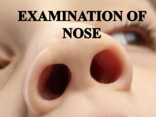 Examination of nose | PPT
