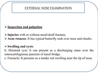 examination of nose.pptx