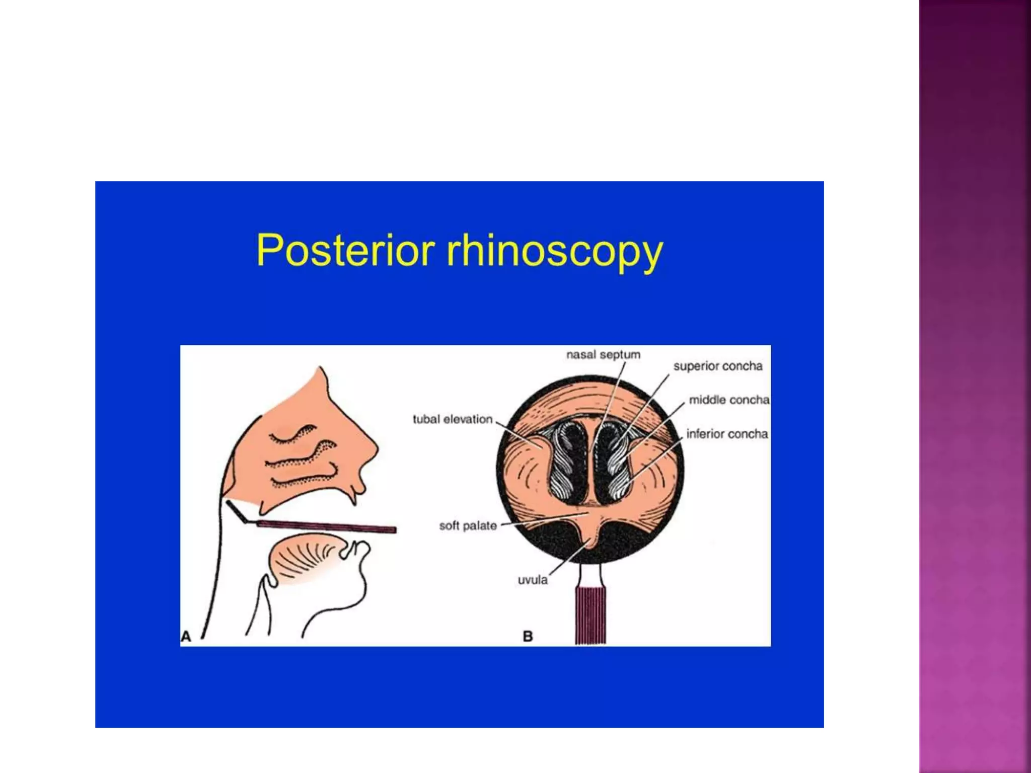 Examination of nose and pns | PPTX