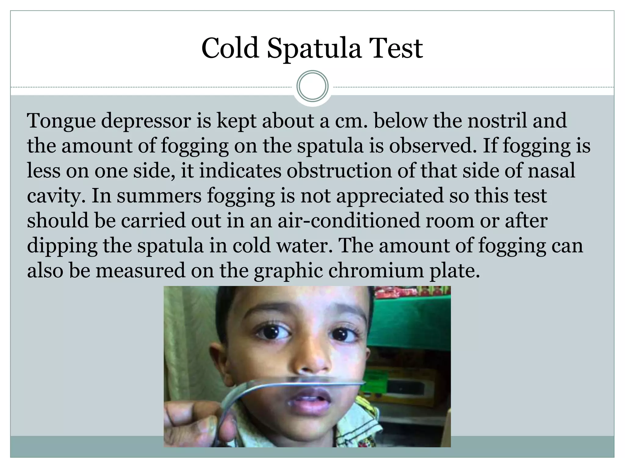 Examination of Nose & Throat Aditi G.pptx