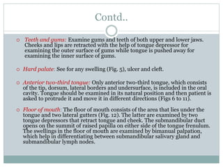 Examination of Nose & Throat Aditi G.pptx