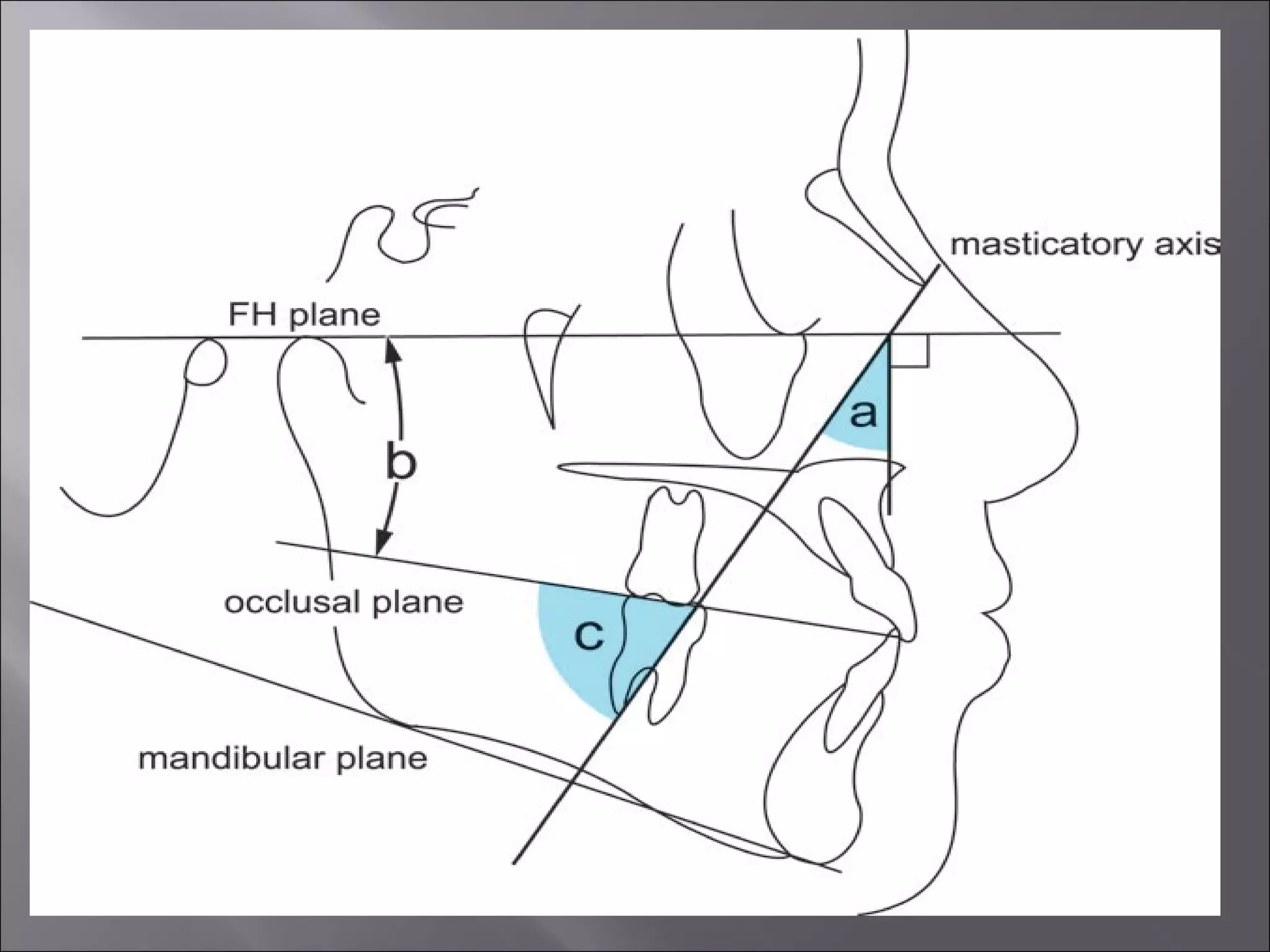 424 Examination of occlusion | PPT
