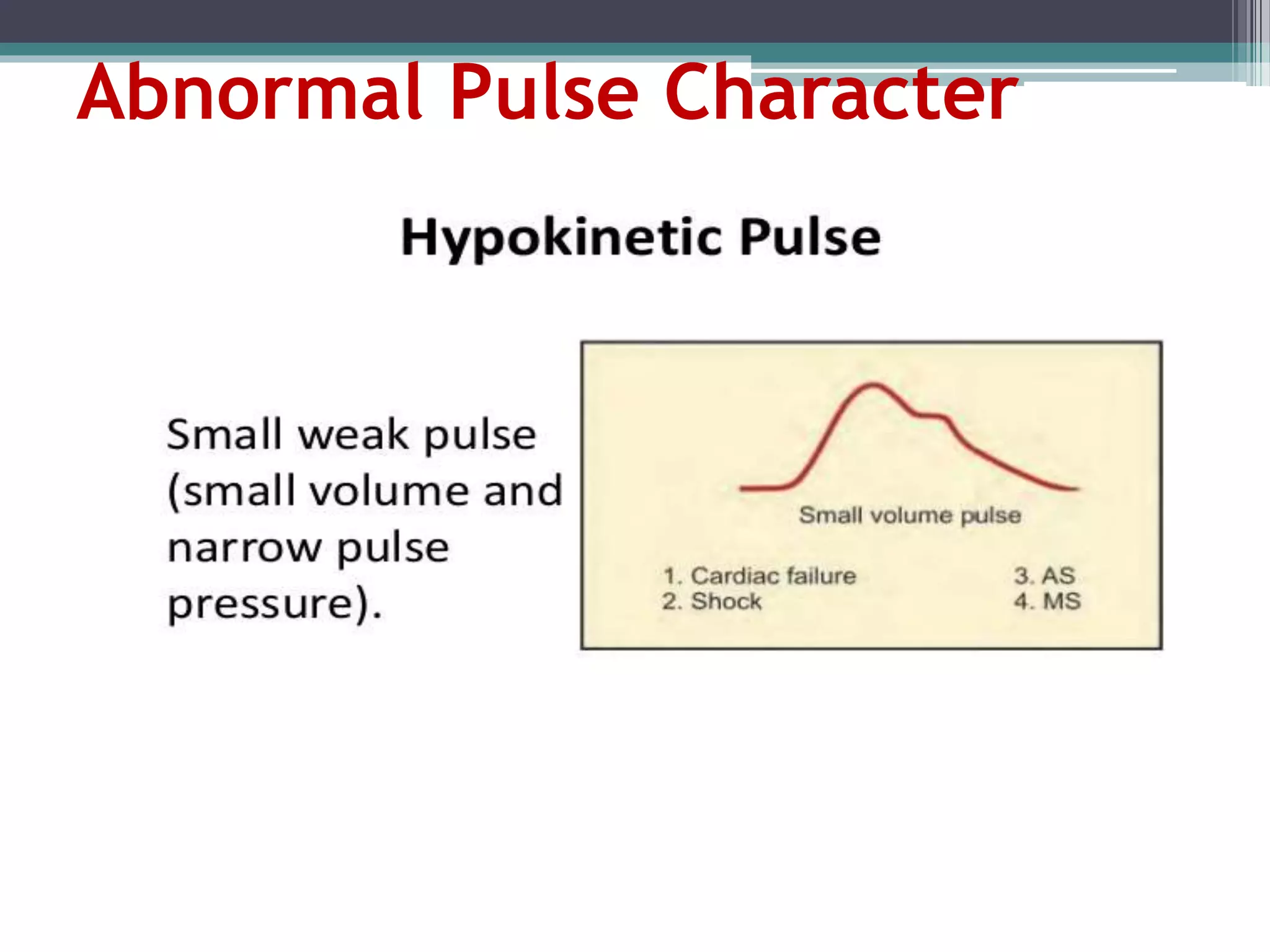 Examination of pulse | PPTX