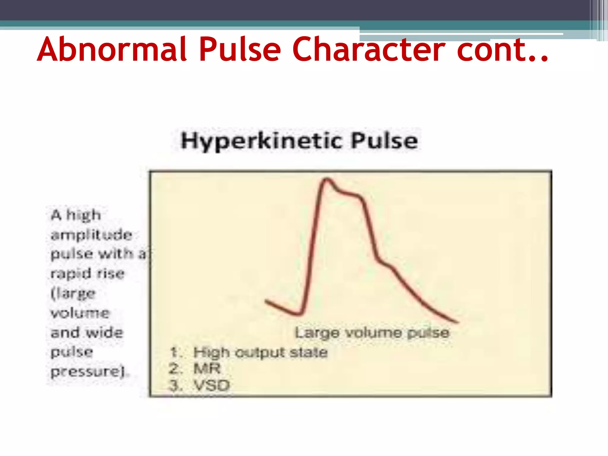 Examination of pulse | PPTX