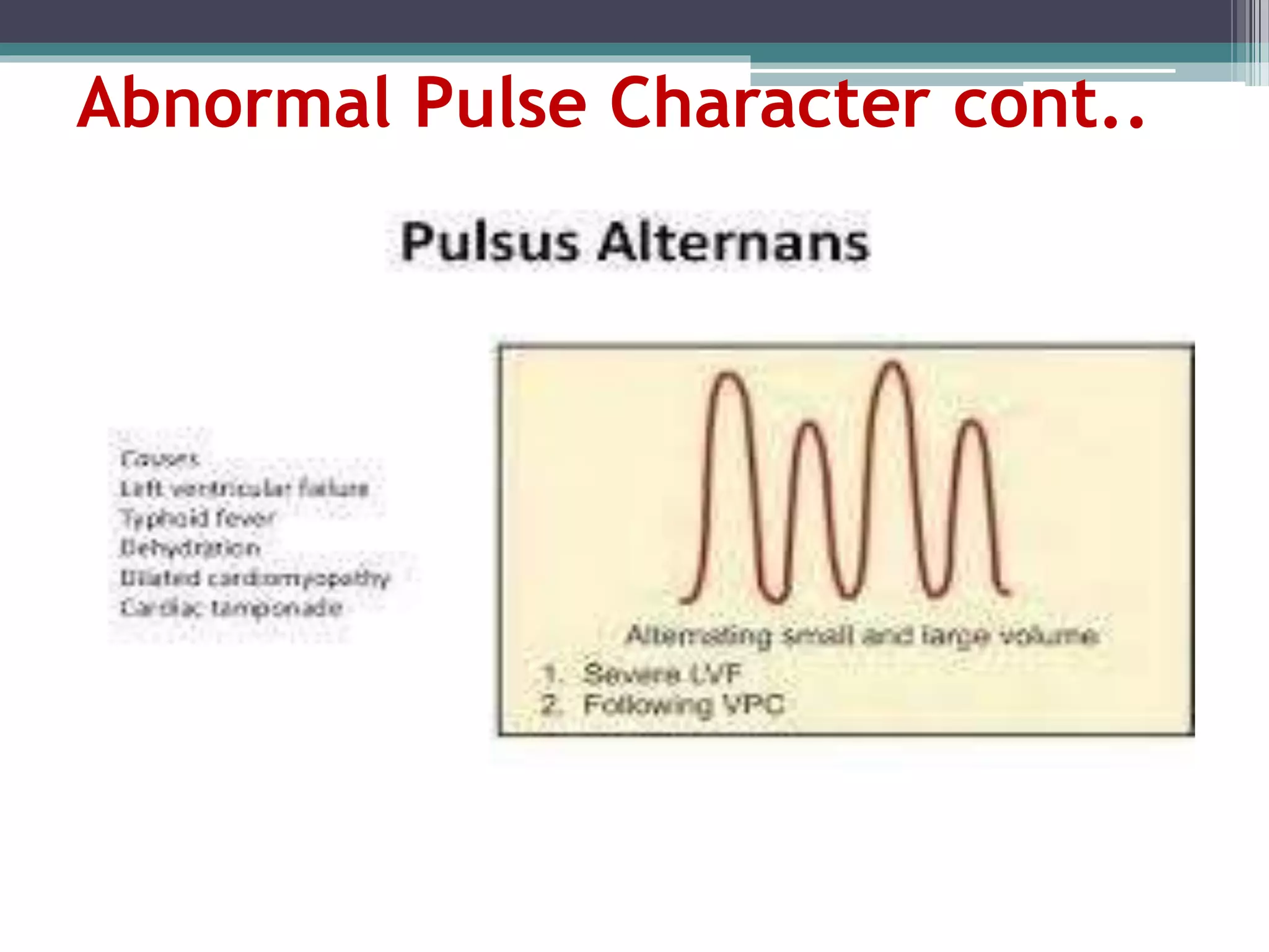 Examination of pulse | PPTX