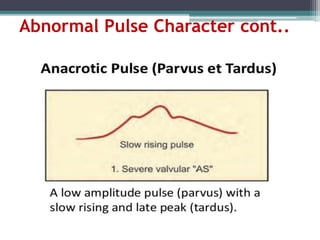 Examination of pulse | PPTX