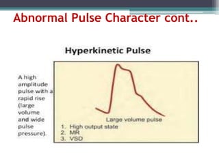 Examination of pulse | PPTX