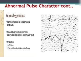 Examination of pulse | PPTX