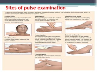 Examination of pulse | PPTX