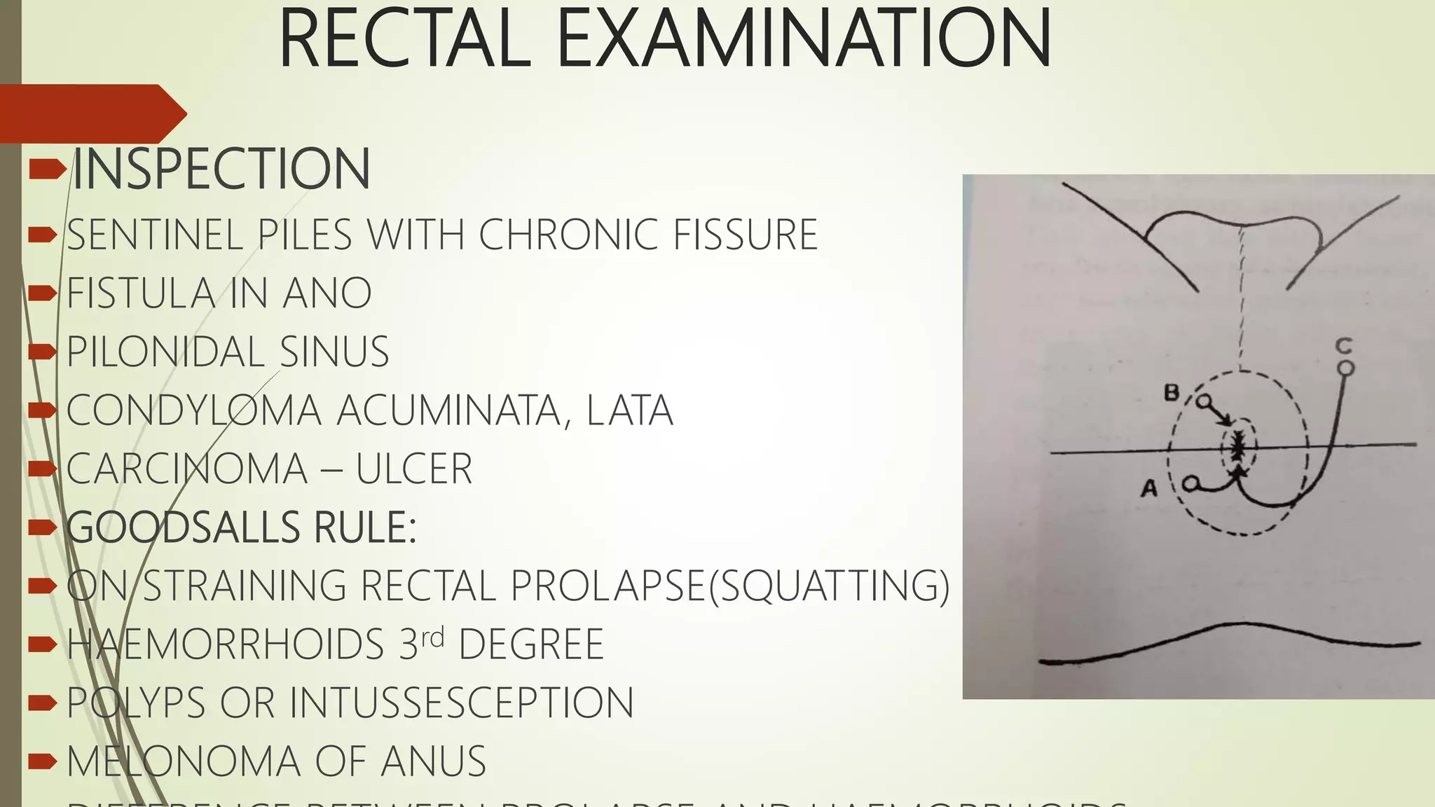 Examination of rectal case | PPTX