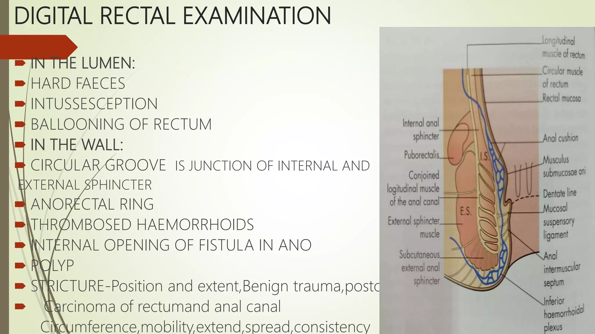 Examination of rectal case | PPTX