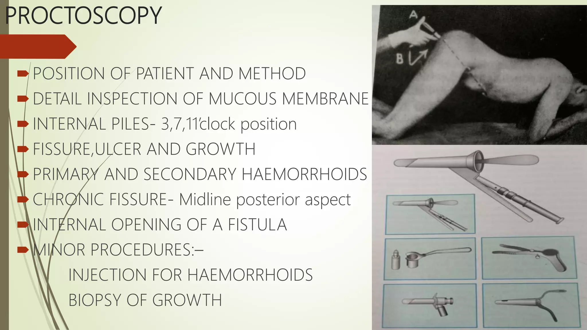 Examination of rectal case | PPTX