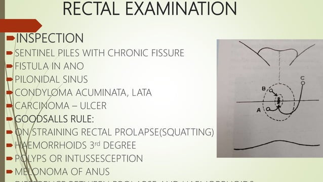 Examination of rectal case | PPTX