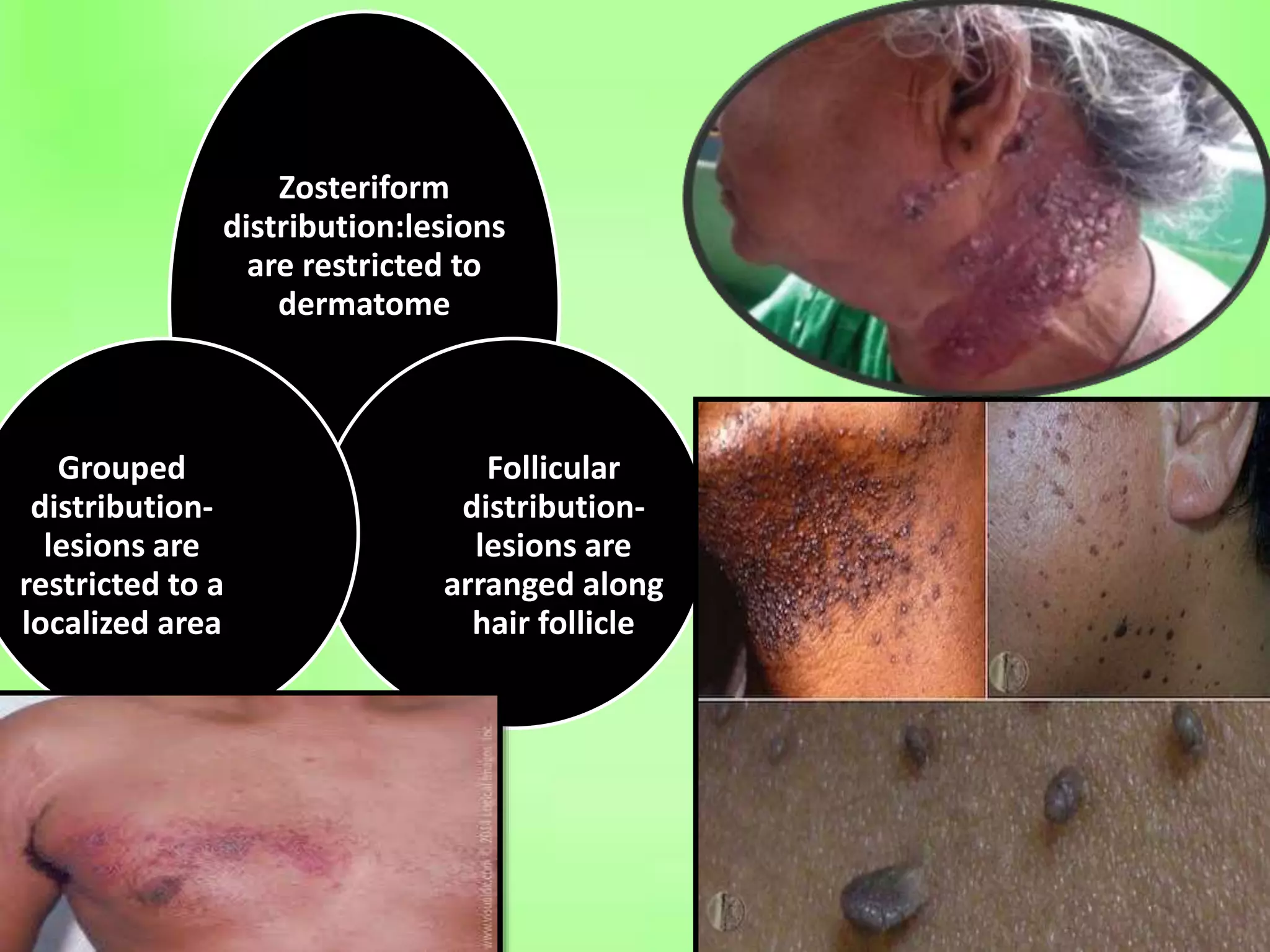 Examination of secondary skin lesion and its applied aspects | PPTX