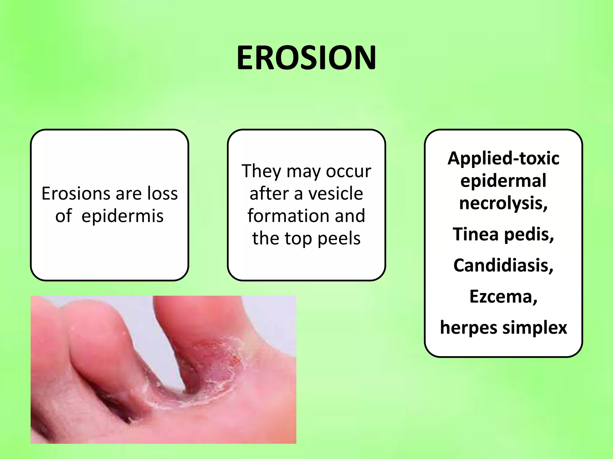 Examination of secondary skin lesion and its applied aspects | PPTX