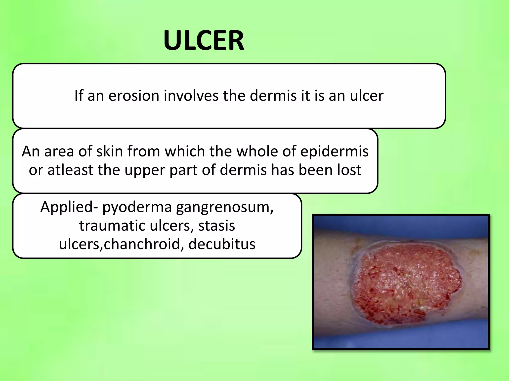 Examination of secondary skin lesion and its applied aspects | PPTX
