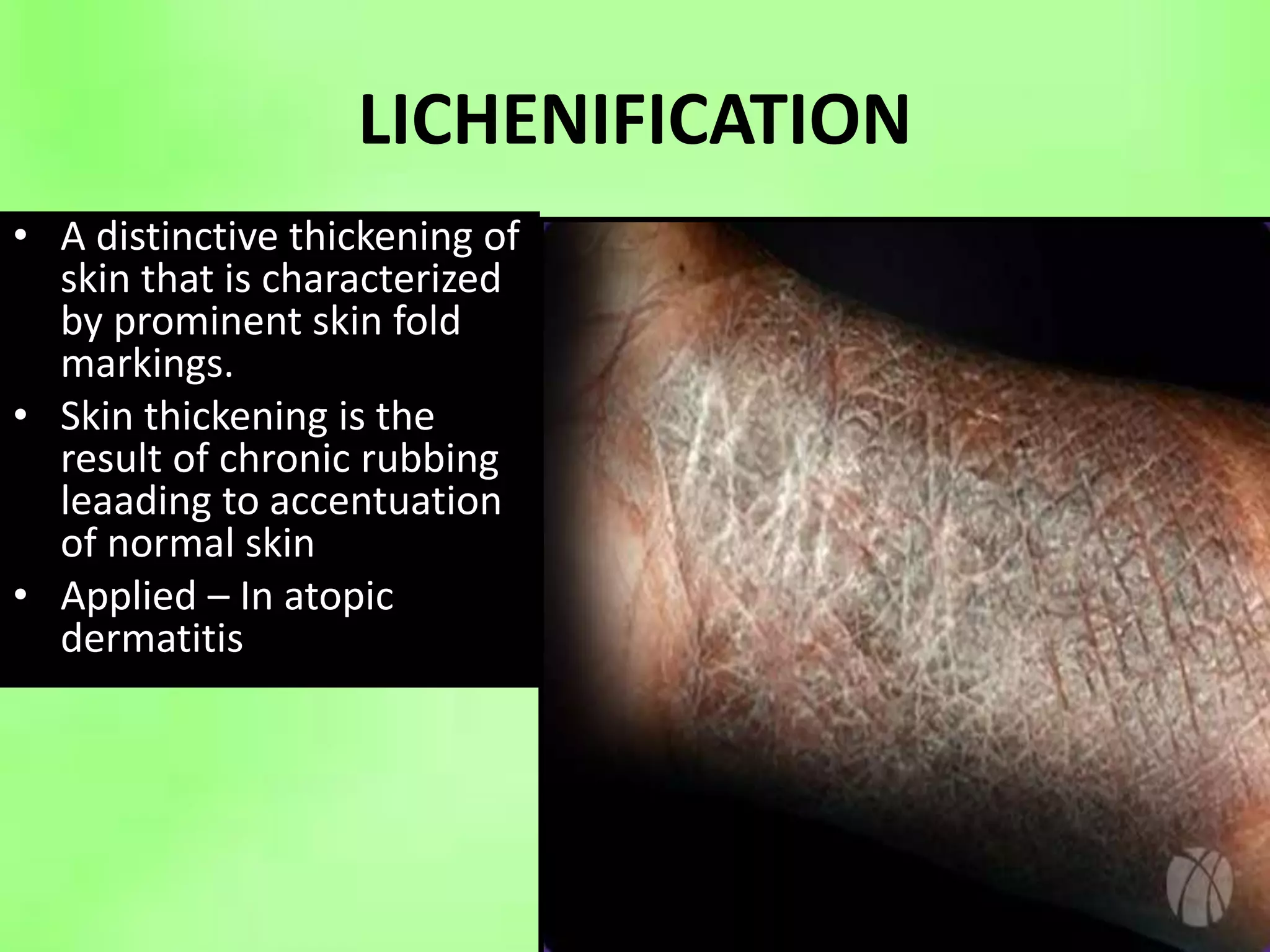 Examination of secondary skin lesion and its applied aspects | PPTX