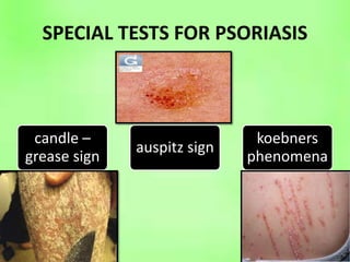 Examination of secondary skin lesion and its applied aspects | PPTX