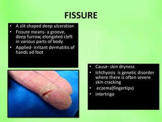 Fissure Skin Lesion