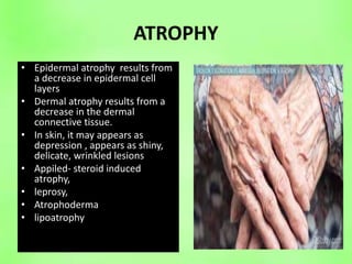 Examination of secondary skin lesion and its applied aspects | PPT