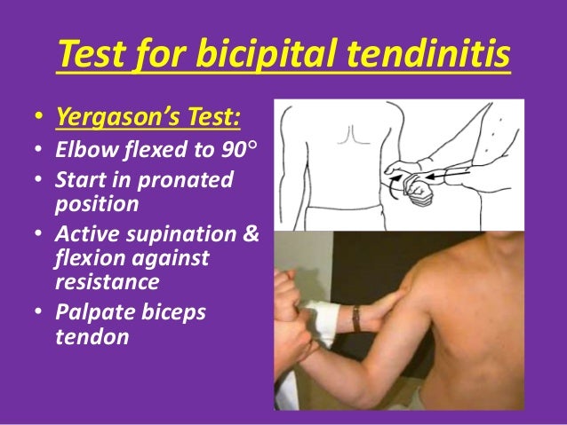 Yergason S Bicep Test Physical Examination For Partial Tears Of The