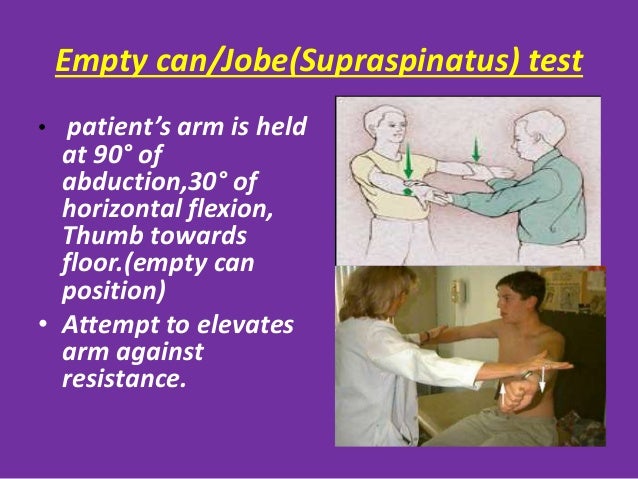 Jobe Empty Can Test Subacromial Pain Syndrome Youtube