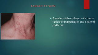 EXAMINATION OF SKIN.pptx