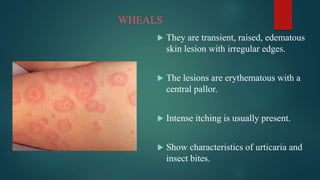 EXAMINATION OF SKIN.pptx