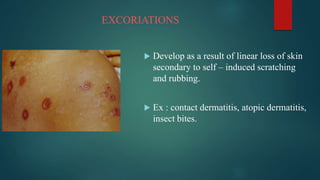 EXAMINATION OF SKIN.pptx