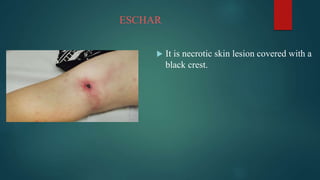 EXAMINATION OF SKIN.pptx