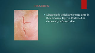 EXAMINATION OF SKIN.pptx