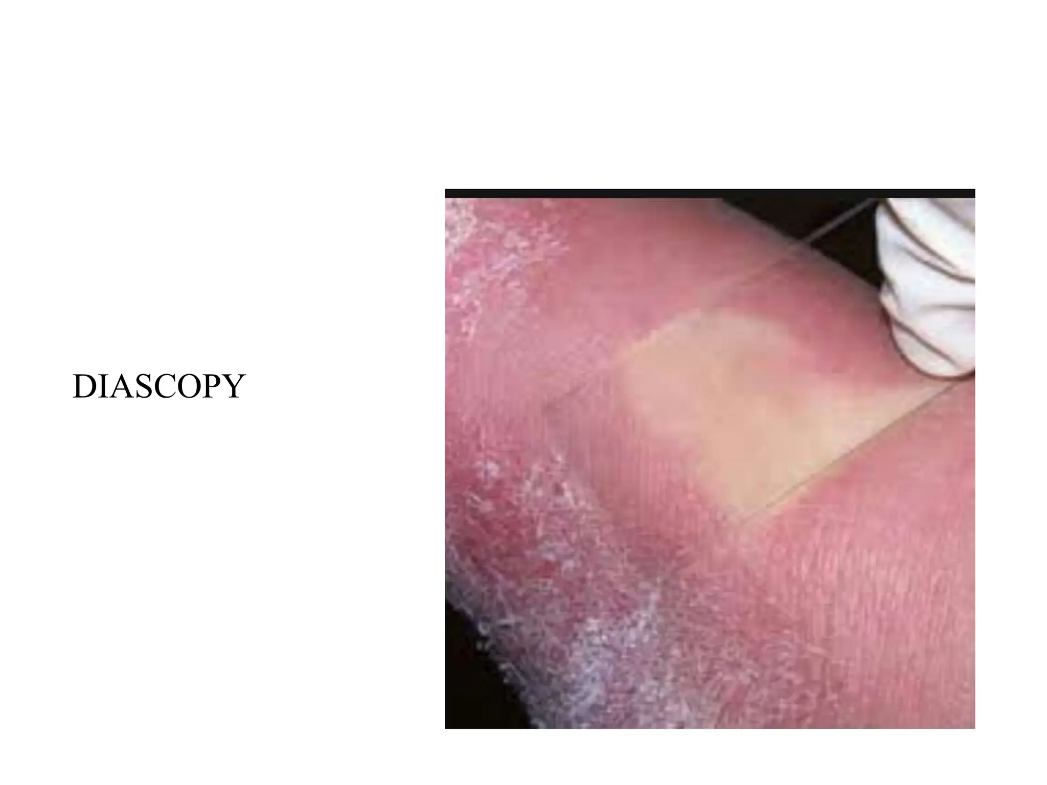 EXAMINATION OF SKIN.pptx and diagnostic tools | PPTX