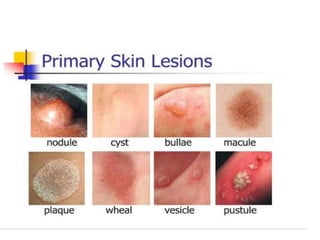 EXAMINATION OF SKIN.pptx and diagnostic tools | PPTX