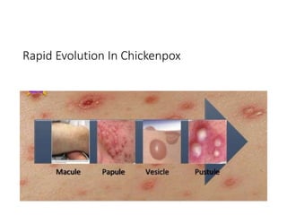 EXAMINATION OF SKIN.pptx and diagnostic tools | PPTX