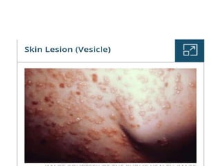 EXAMINATION OF SKIN.pptx and diagnostic tools | PPTX