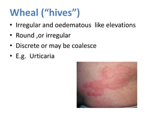 Examination of skin | PPTX