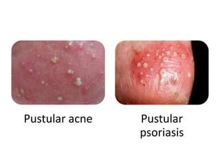 Examination of skin | PPTX