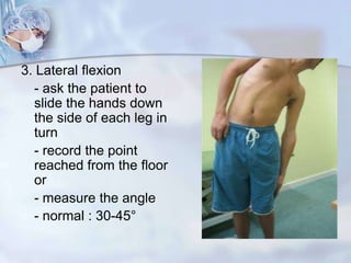 Examination of spine | PPTX