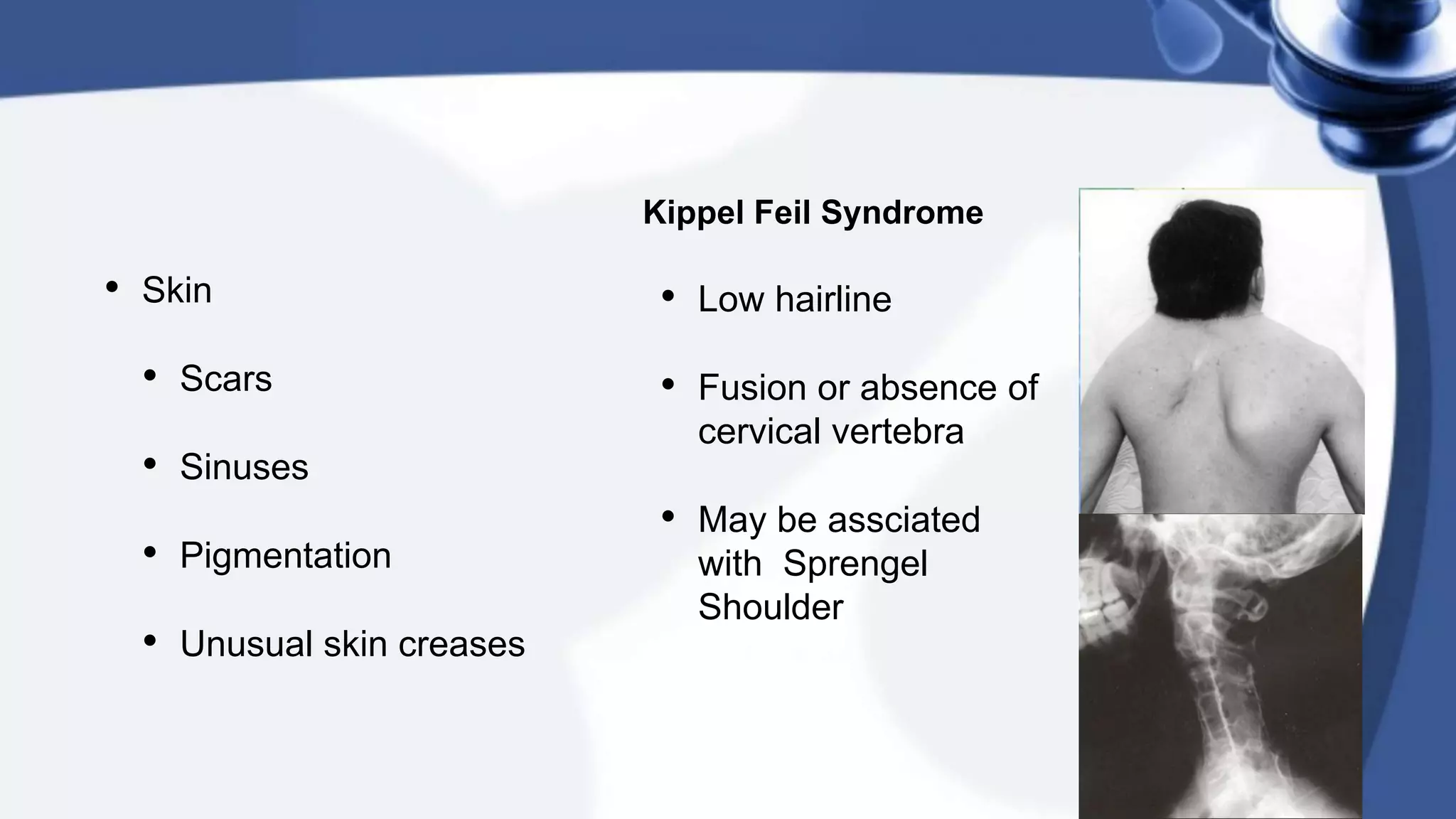 Examination of spine | PPTX