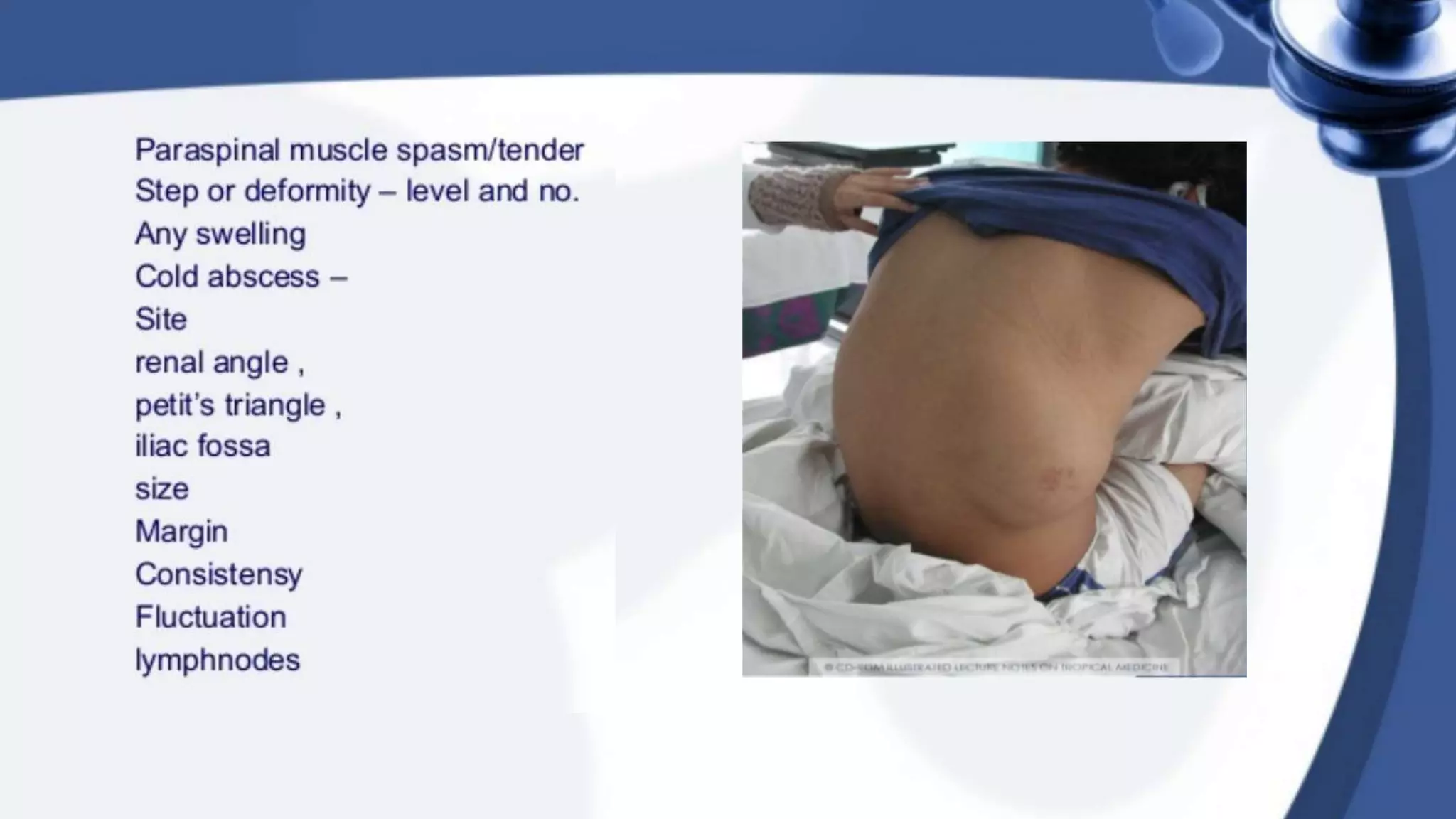 Examination of spine | PPTX