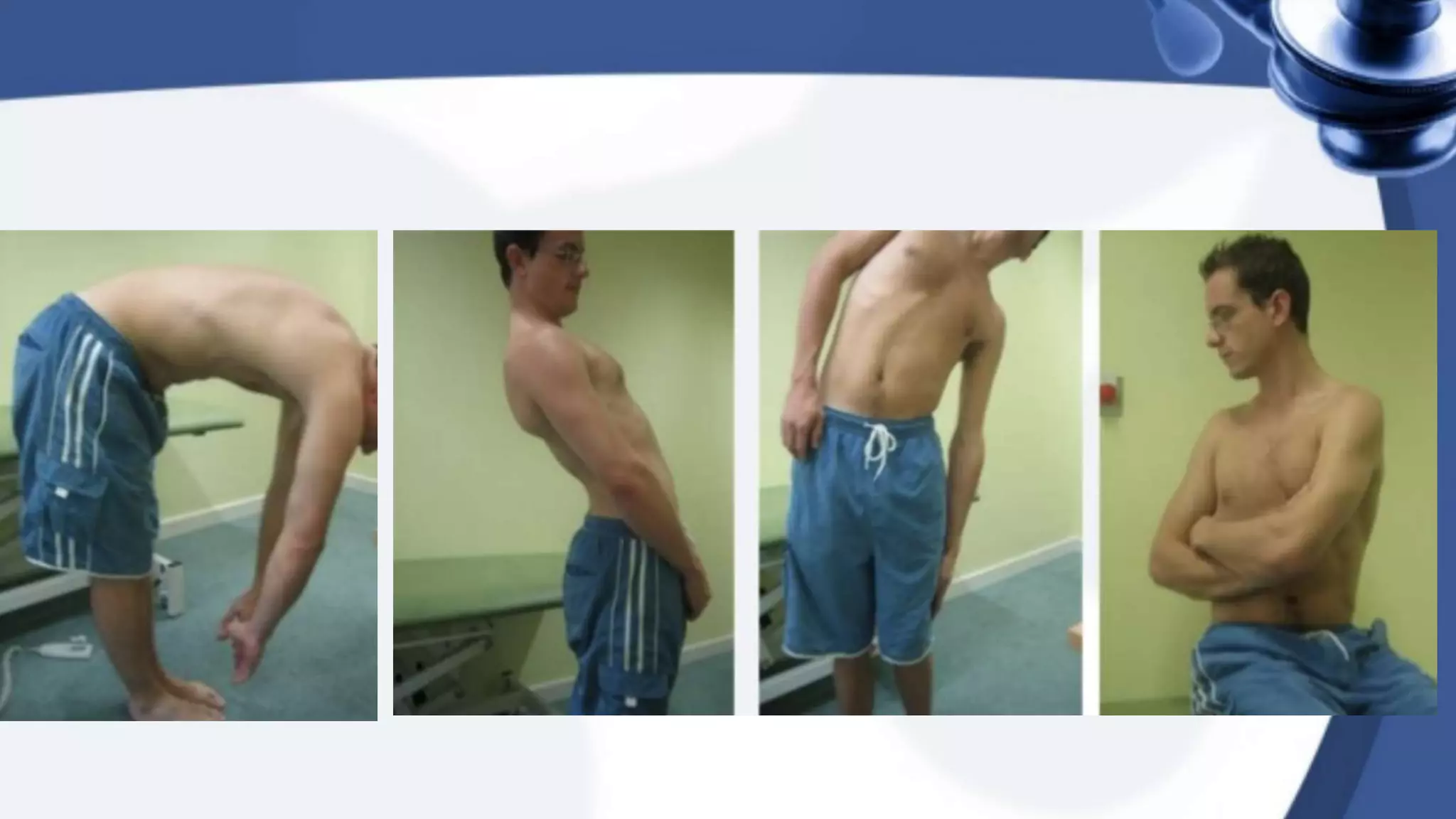 Examination of spine | PPTX