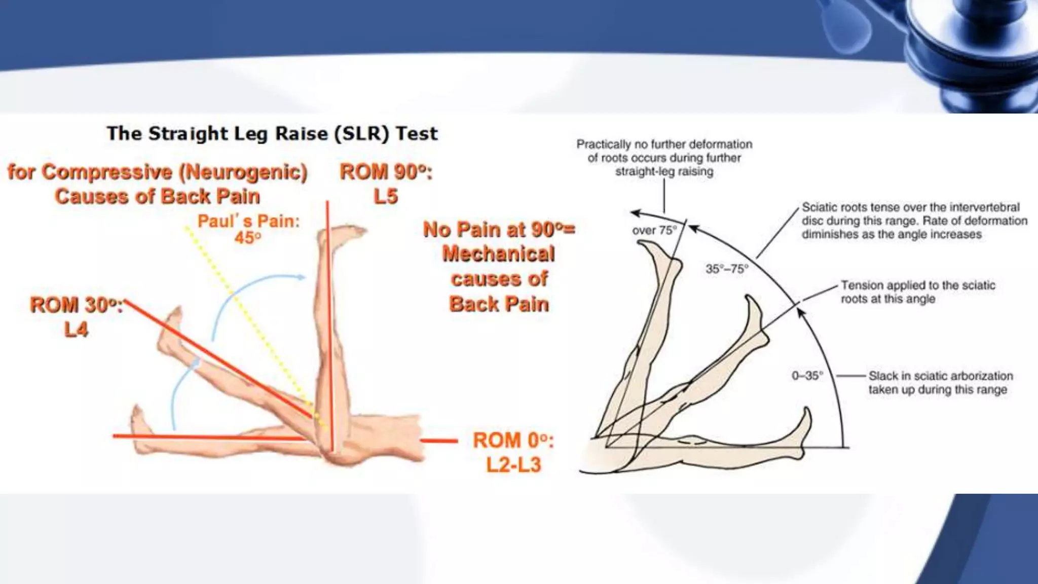 Examination of spine | PPTX