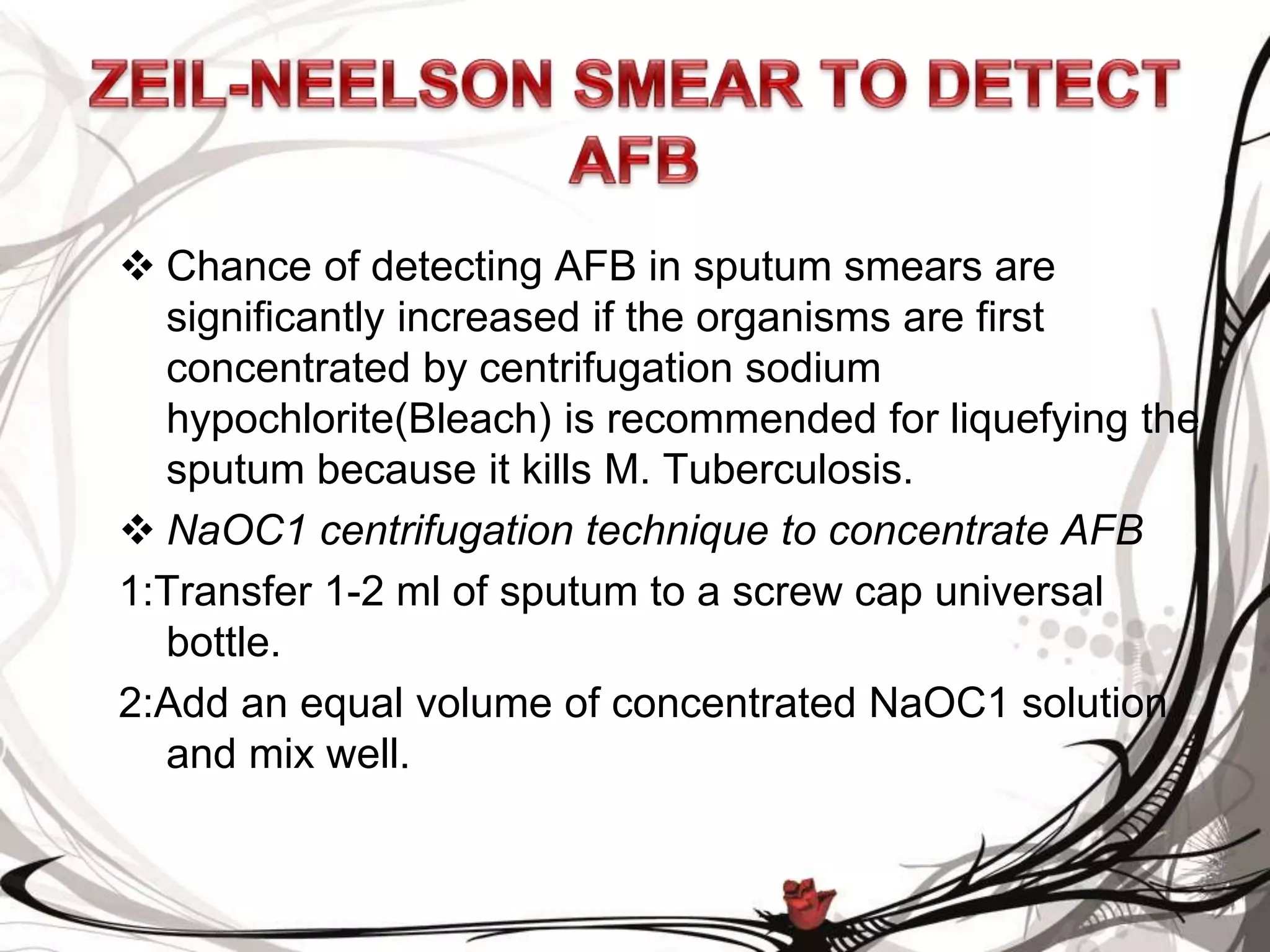 Examination of sputum | PPTX