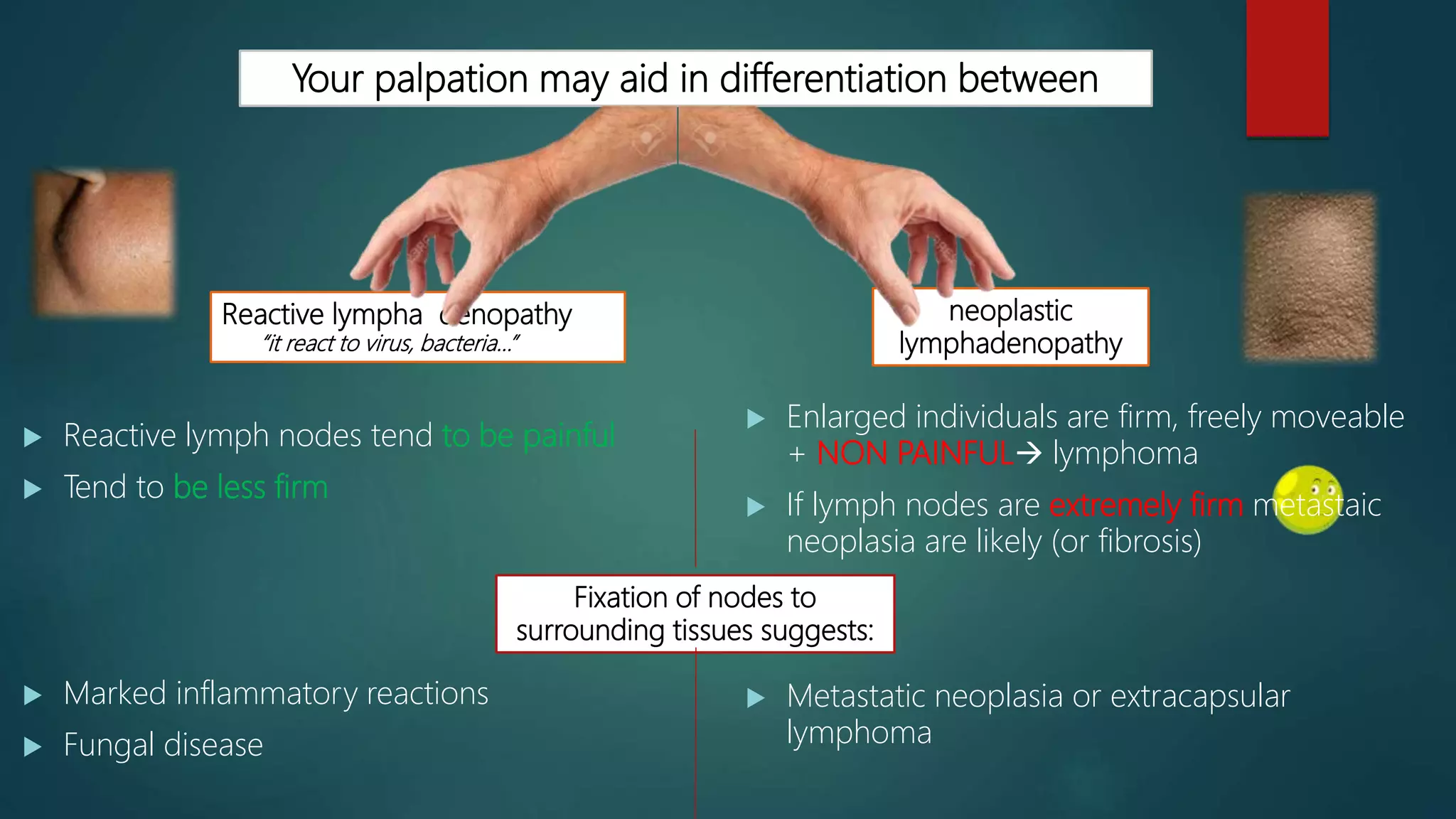 Examination of superficial lymph nodes in dogs and cat | PPTX